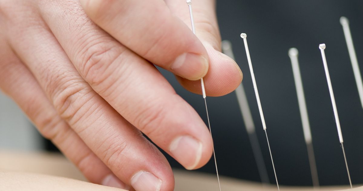 Nature Acupuncture Benefits and Three Phases of Therapy – Ceramica ...
